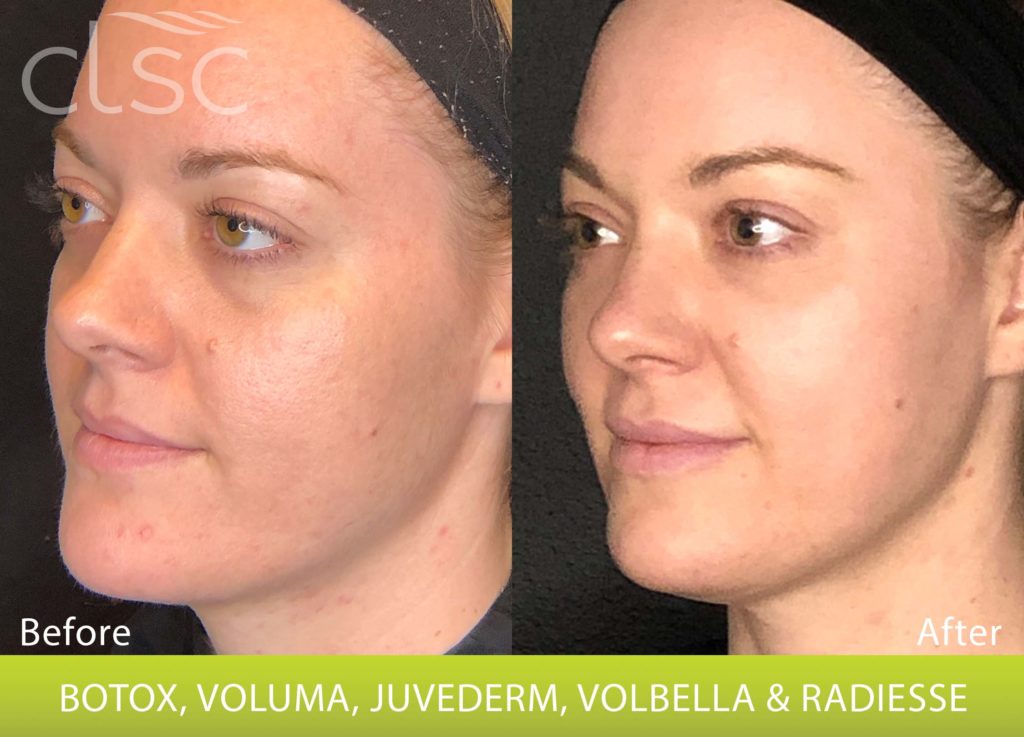 Total Transformations - Before and After | Columbia Laser Skin Center