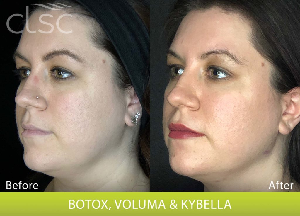 Total Transformations - Before and After | Columbia Laser Skin Center